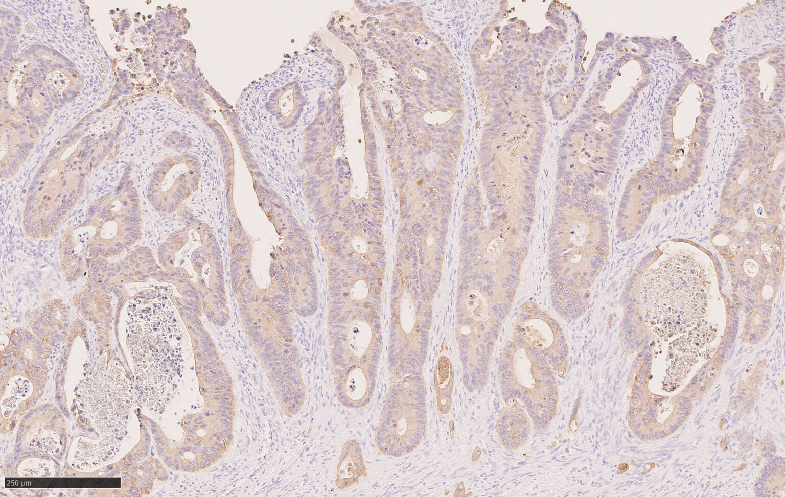 IHC(免疫組織化学染色） - Genostaff